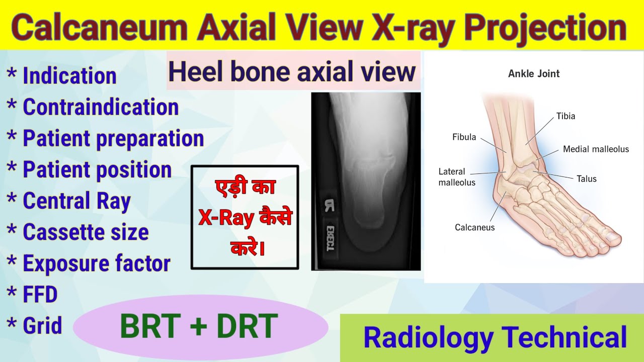 Calcaneum Axial View X-ray Projection # Heel bone radiography # Patient ...