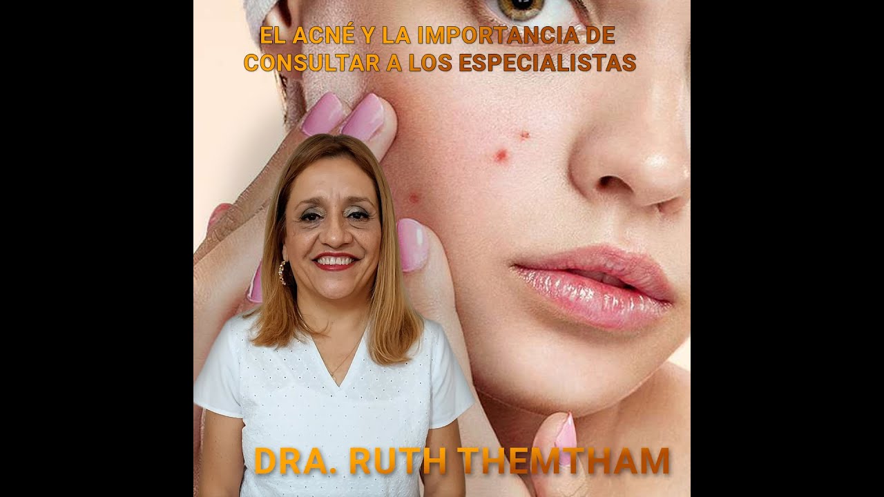 DERMATOLOGÍA | El Acné y la importancia de consultar a los ...