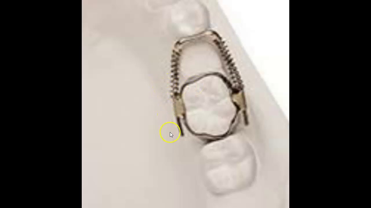 What Is An Open Coil Appliance at Eldon Berthold blog