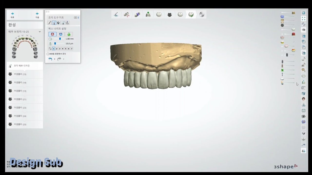 3shape design full arch diagnosis - YouTube