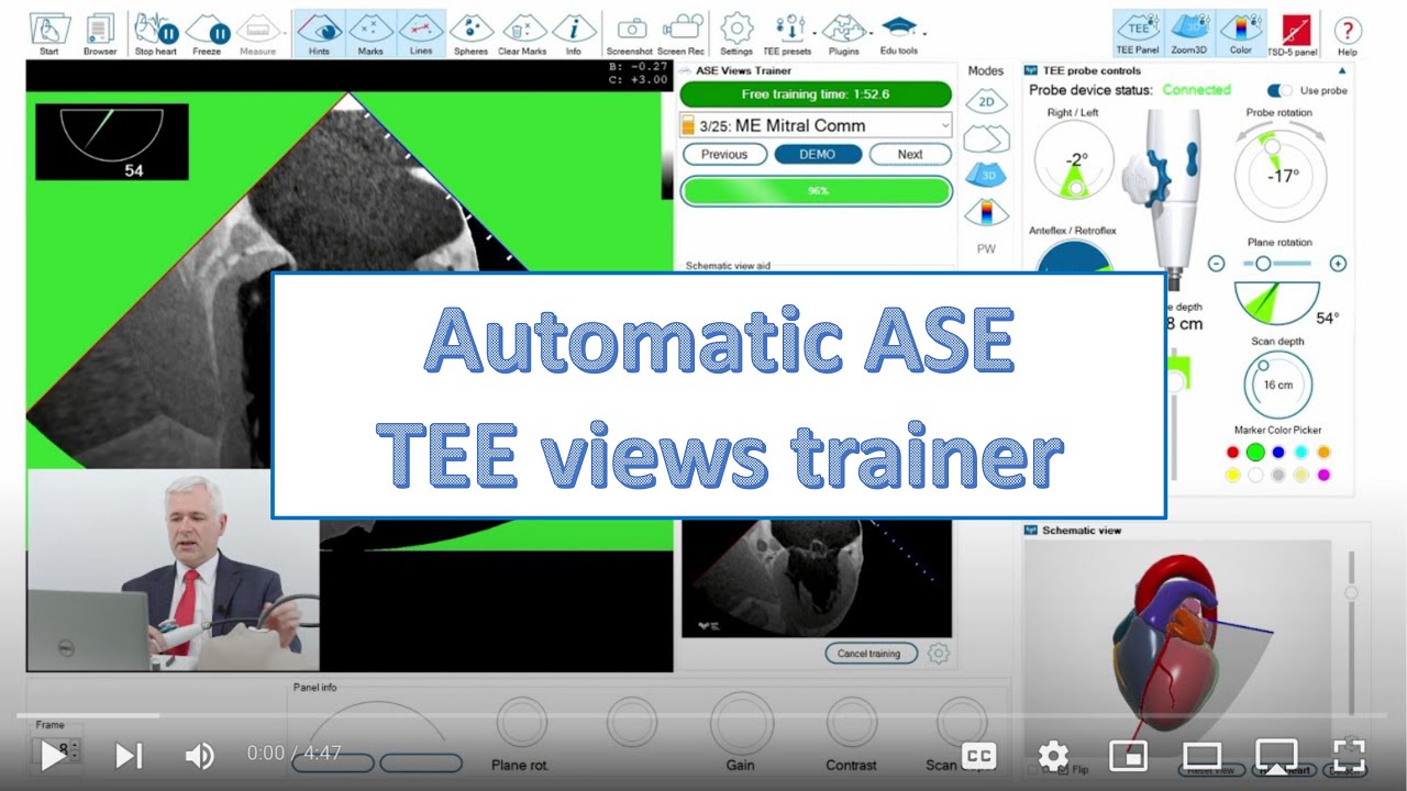Automatic ASE TEE Views Trainer - YouTube