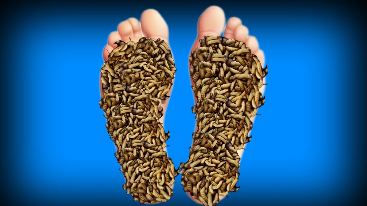 Asmr video treatment leg and foot foot 👣 infection injection Ani girls ...