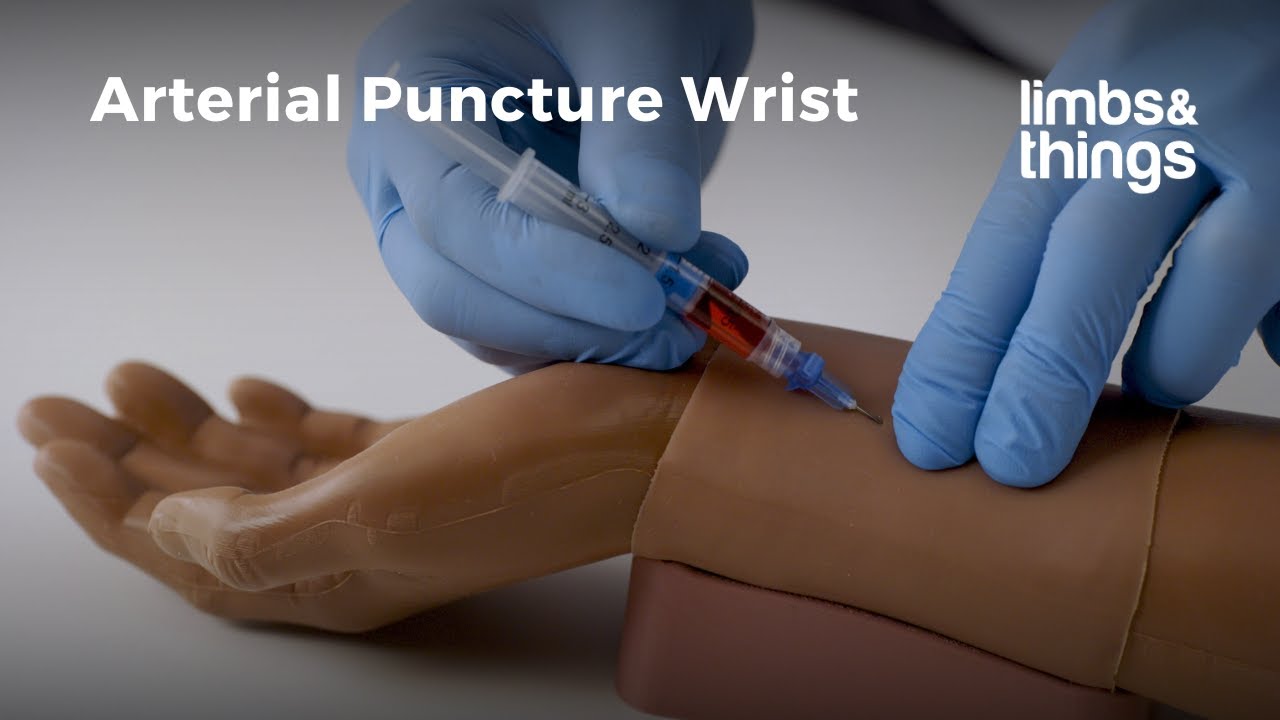 Arterial Puncture Wrist - YouTube