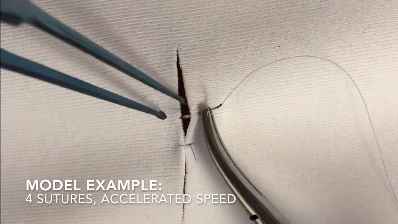 Conjunctiva Closure- Interrupted Suture - YouTube