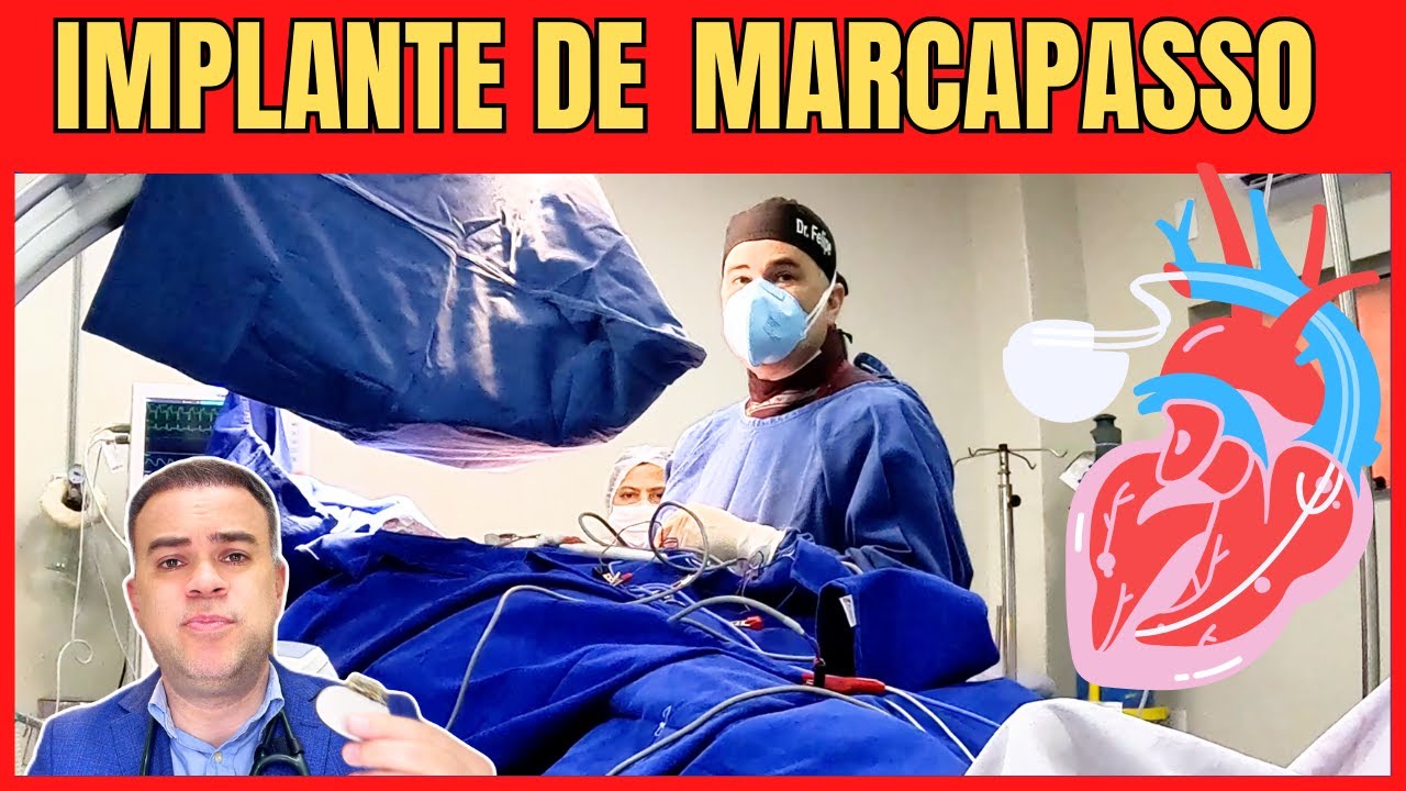 ASSISTA uma CIRURGIA de implante de MARCAPASSO BICAMERAL - YouTube