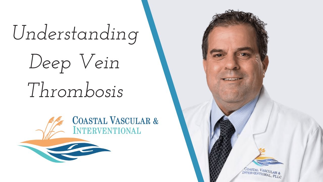 Understanding Deep Vein Thrombosis (DVT) | Coastal Vascular ...