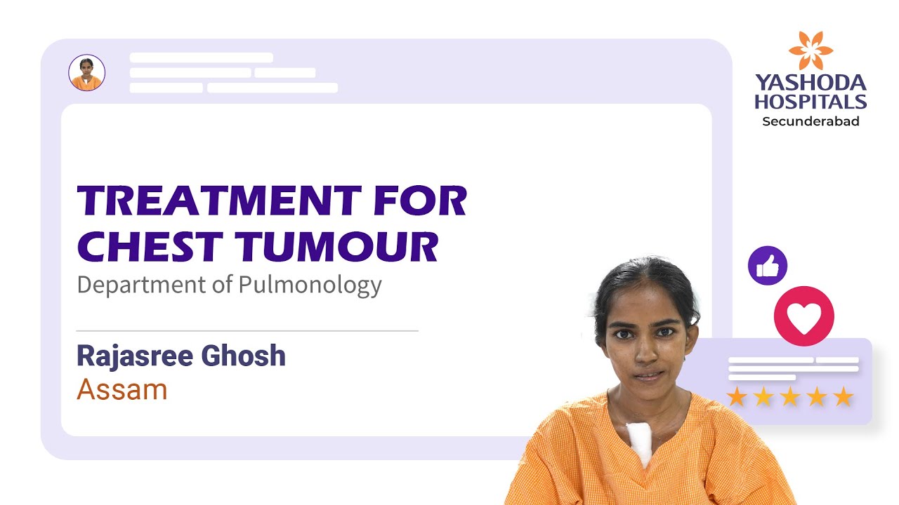 Treatment for Chest Tumor | Surgical Removal of Chest Tumor - YouTube