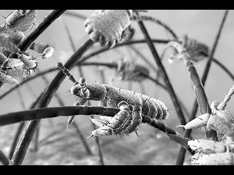 Trench fever, a disease transmitted by lice, re-emerges in the US WHY ...