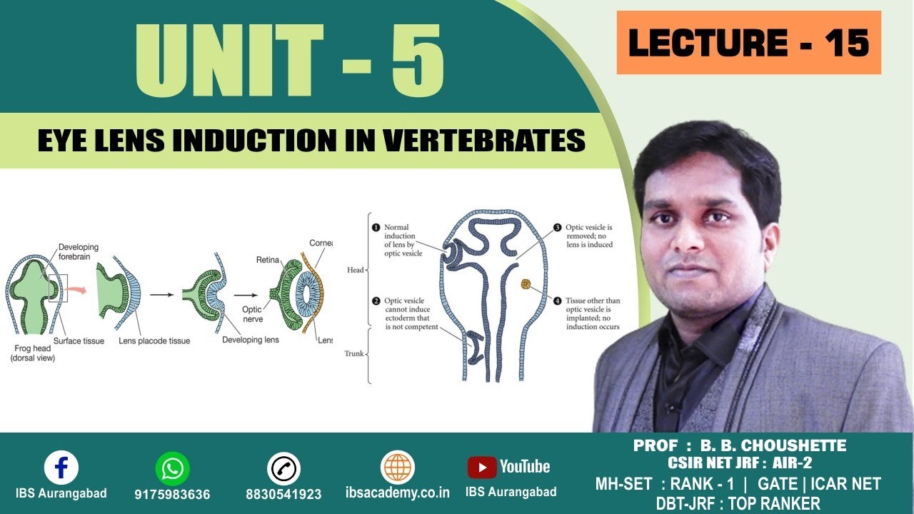 Eye Lens Induction at Jonathan Landseer blog