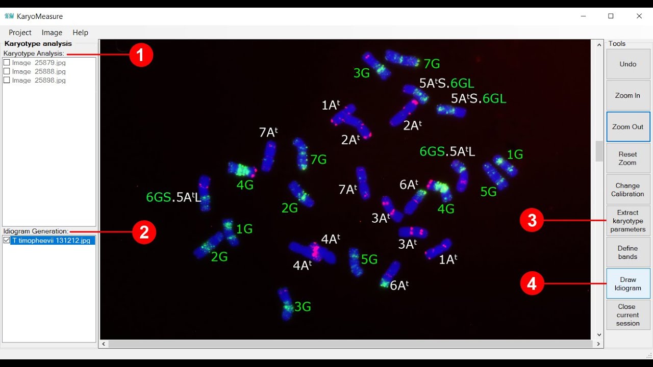 Karyotype analysis using KaryoMeasure - YouTube