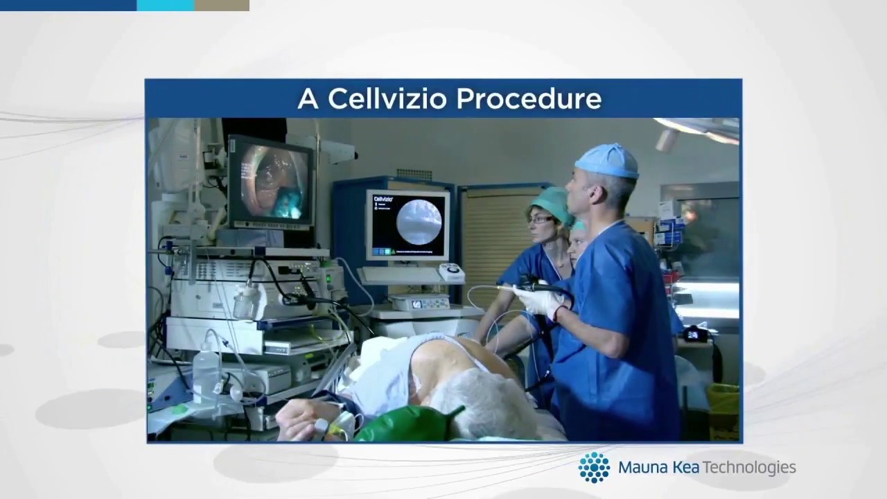 An Introduction to Cellvizio Targeted Biopsy - YouTube