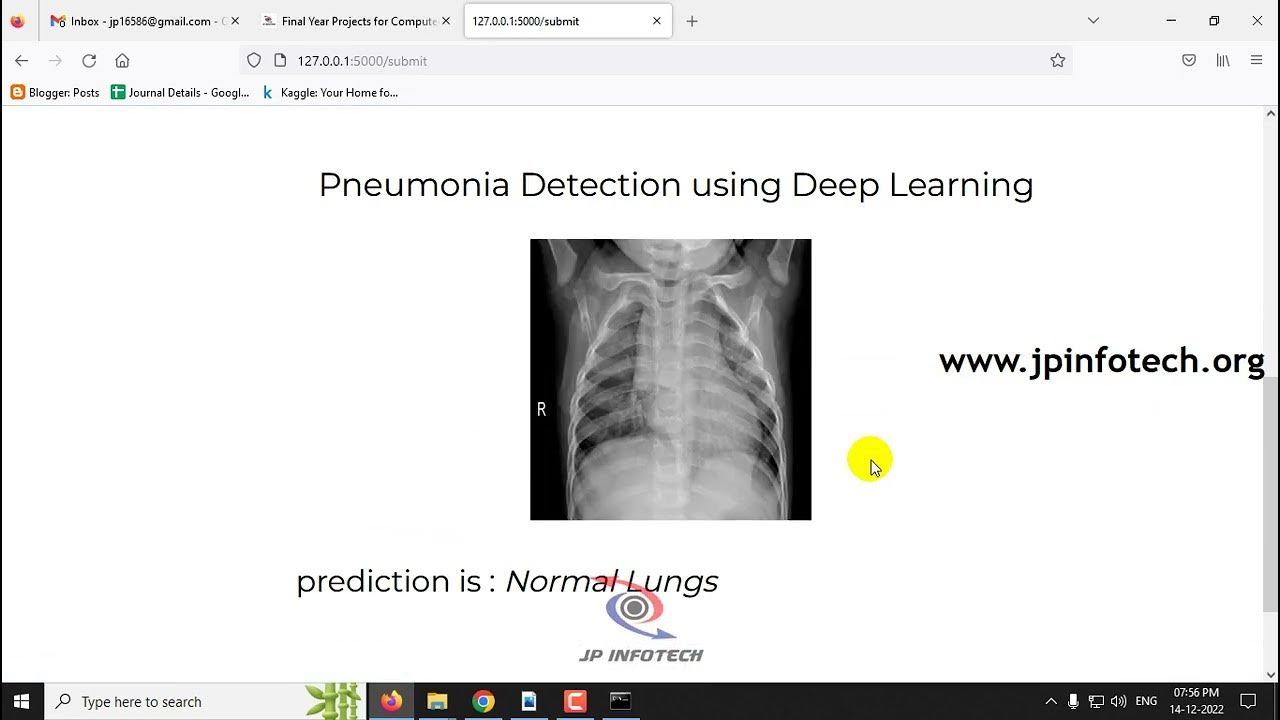 Pneumonia Detection using Deep Learning | Python Final Year IEEE Project - YouTube