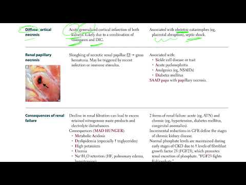 USMLE - #42 Diffuse Cortical necrosis (USMLE Step 1)