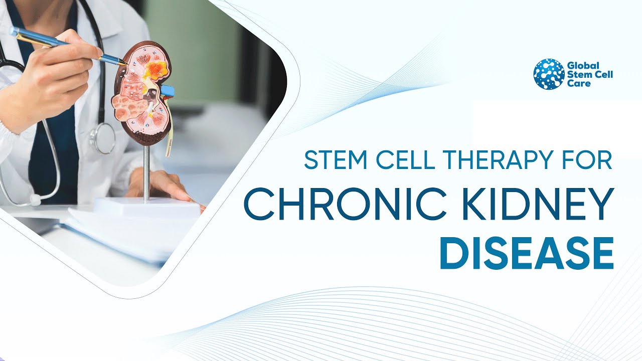 Best Treatment For CKD | Chronic Kidney Disease | Stem Cell Treatment ...