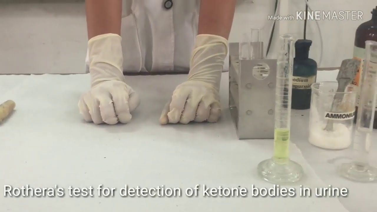 Rothera's test for detection of Ketone body in urine ।Laboratory। Blood ...