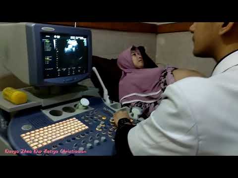 Proses Persalinan Bayi. (Baby Zheaa)