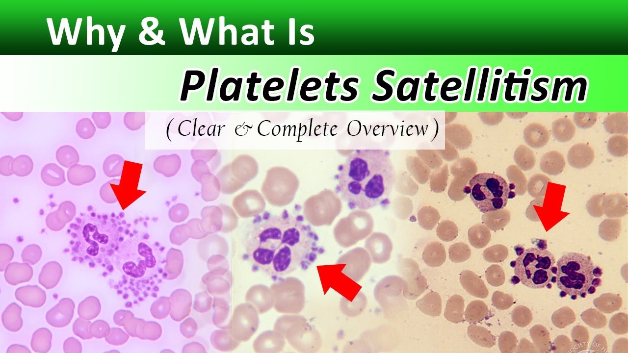 What is Platelets Satellitism ? ( Increase Your Identification Skills ...