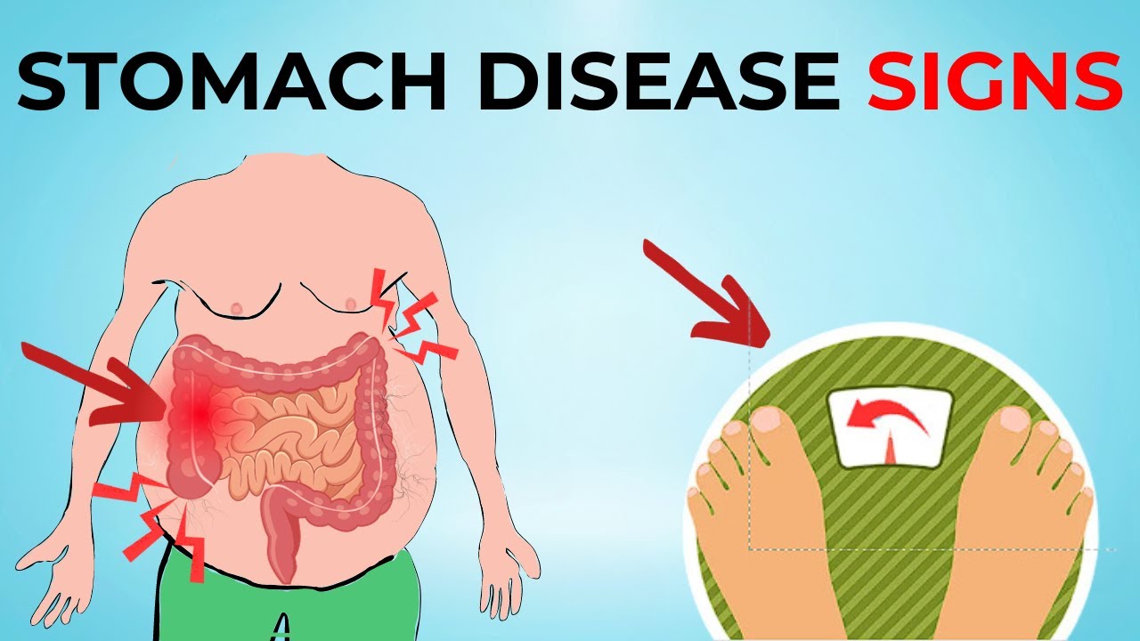 A Silent Threat: 8 Signs That Could Indicate Stomach Disease | Winning ...