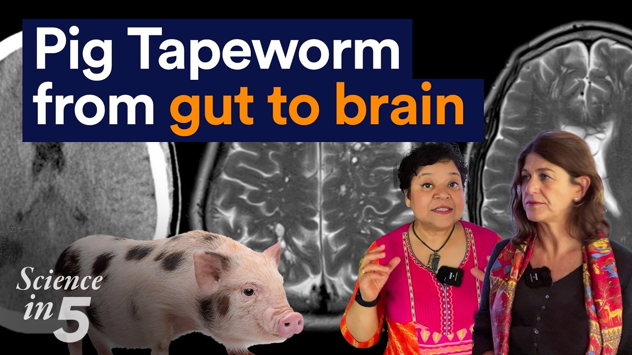 WHO's Science in 5 - Pig Tapeworm: from gut to brain - 24 October 2025 ...
