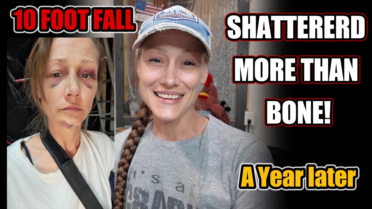 10-foot Fall Shattered More Than Bone! |Off-Grid Cabin Build - YouTube