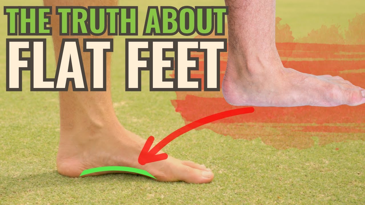 FLAT FEET | Debunking the MYTHS and MISCONCEPTIONS & What You Can Do ...