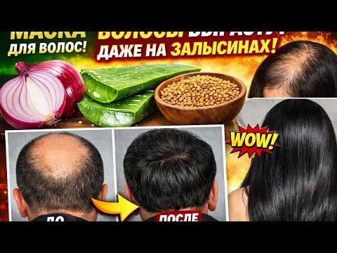 Спасаем волосы народными средствами и результат будет! 