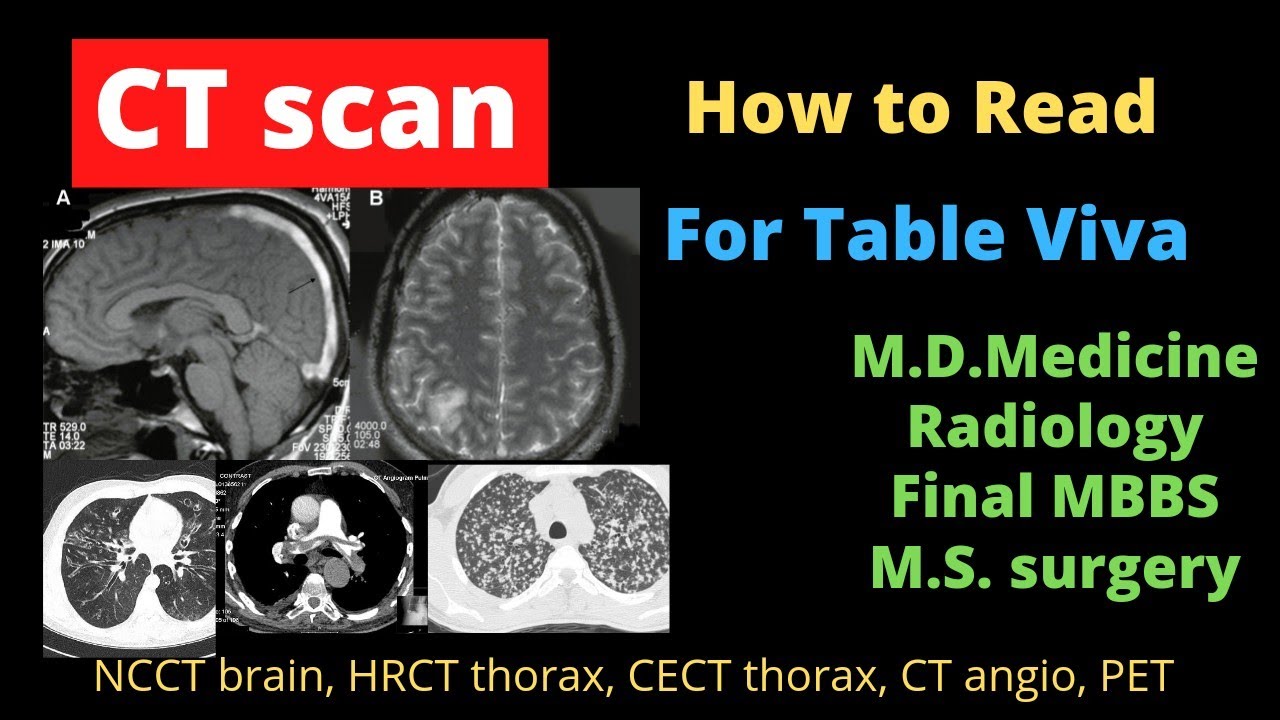 CT scan identification | Read CT scan plate for table viva | MBBS, MD ...