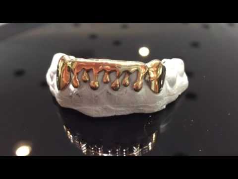 Drip style gold custom grillz - YouTube