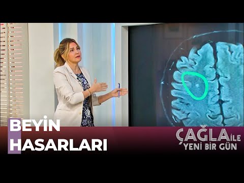 Koronavirüsün Beyinde Bıraktığı Hasarlar - Çağla İle Yeni Bir Gün 531. Bölüm