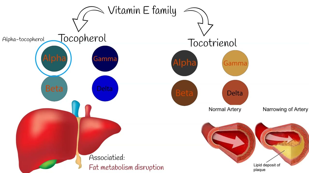 Vitamin E Deficiency