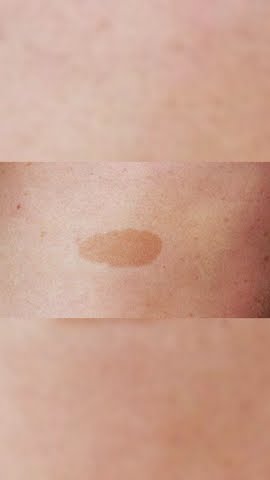 Did You Know the Devil’s Mark Could Be Real? 😱👹 #ScaryFact - YouTube