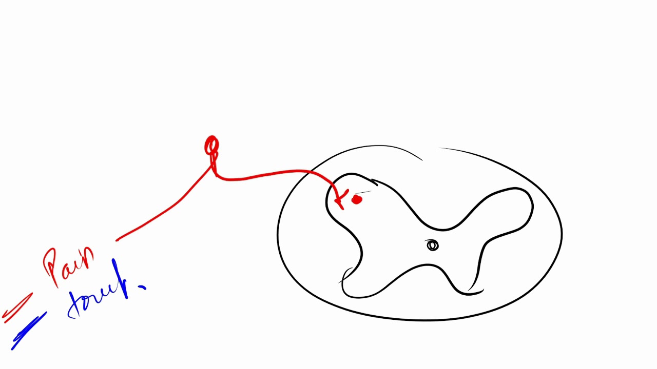 Gate control theory / mechanism / Pathway ( Physiology of Pain / CNS ...