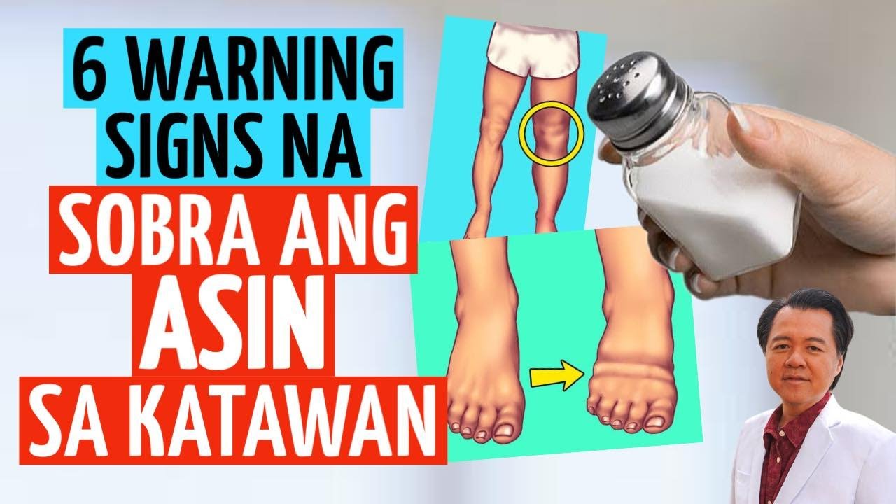 6 Warning Signs na Sobra ang Asin sa Katawan - By Doc Willie Ong - YouTube