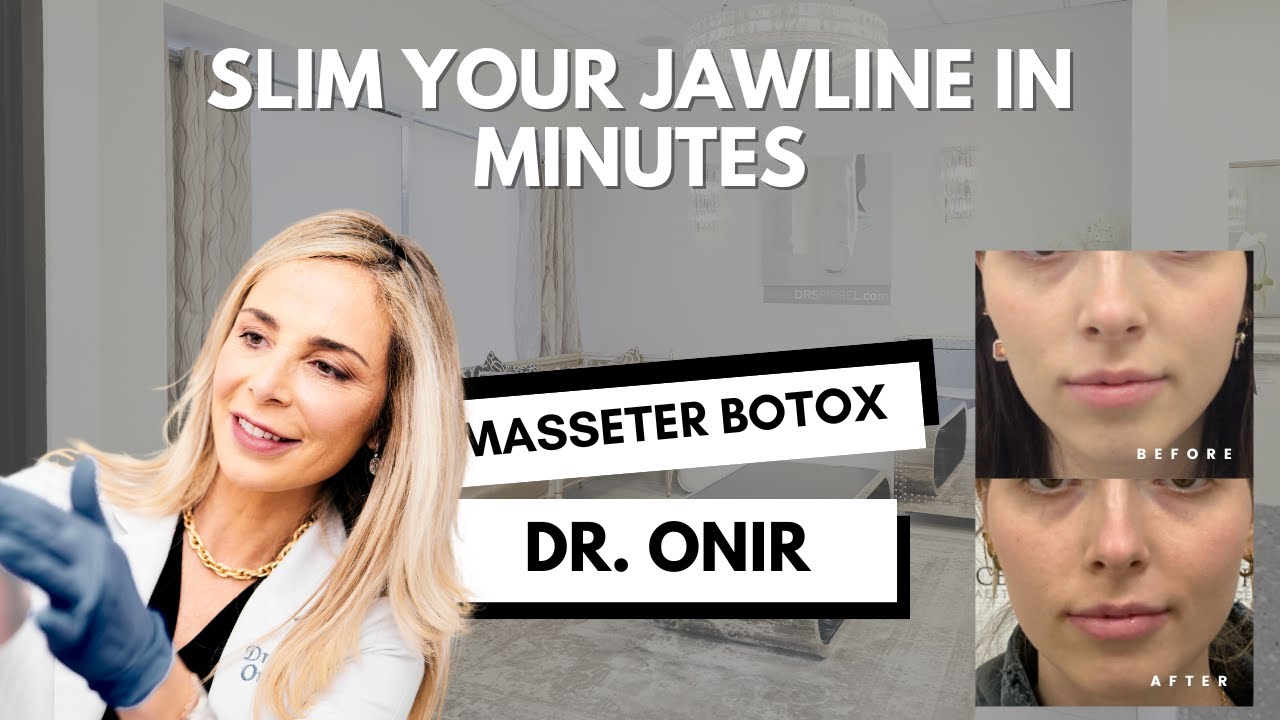 Perfect Your Jawline in Minutes with Masseter Botox - Live Treatment ...
