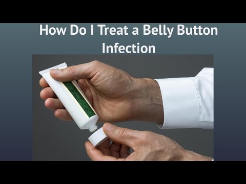 What Antifungal Cream Is Best For Belly Button Infection