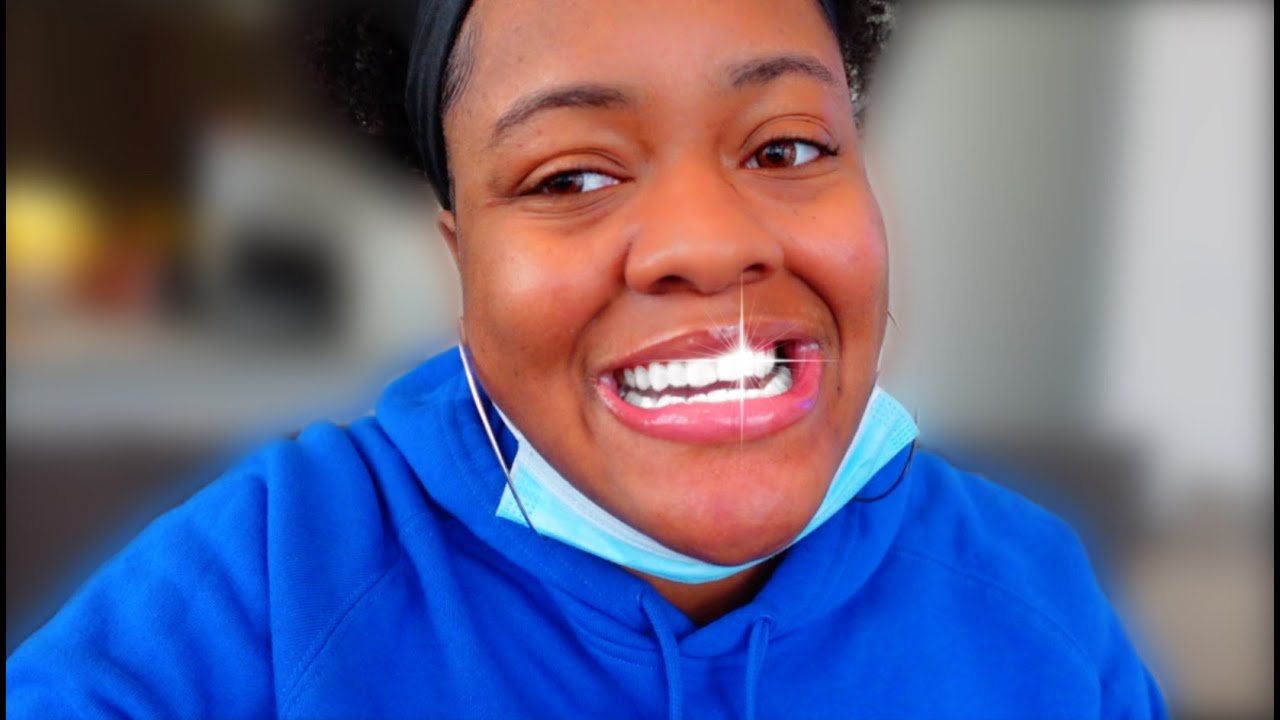 I BLEACHED MY TEETH AND THIS IS WHAT HAPPENED😮🤦‍♀️........... | @Jay ...