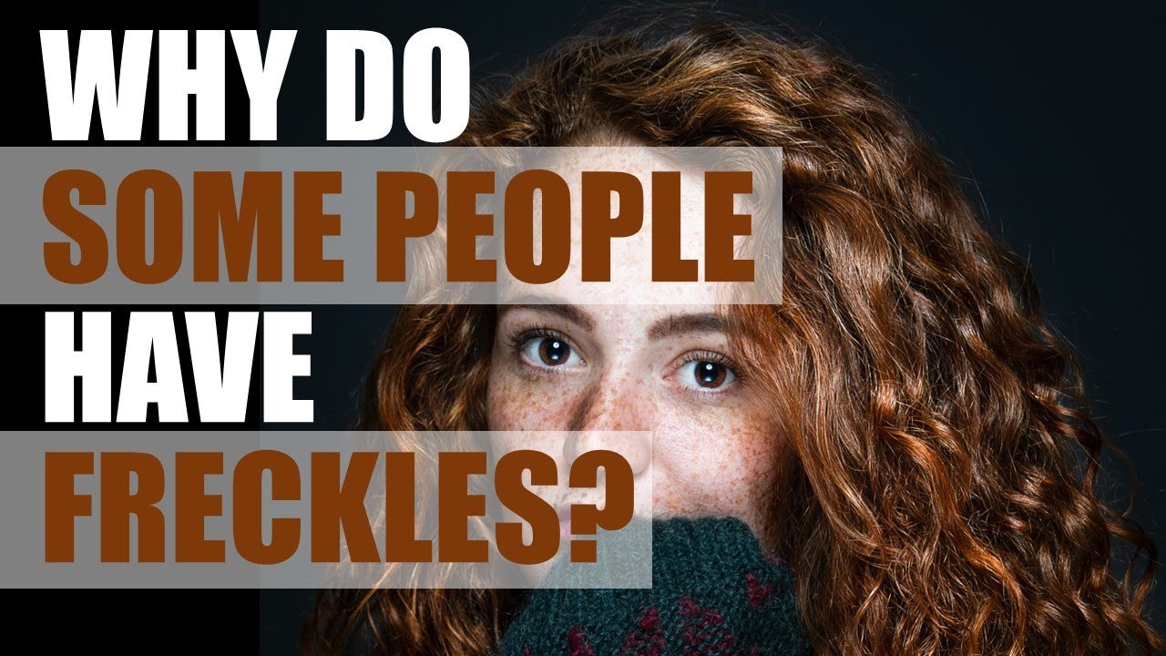 Why Do Some People Have Freckles? - YouTube