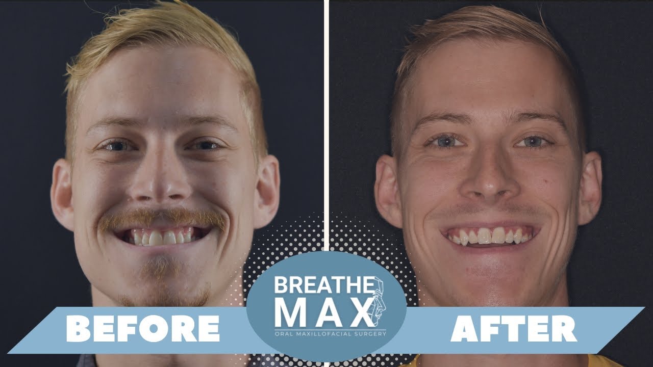 Patient Testimonial: Sam Franklin on MIND expansion with Dr. Kevin ...