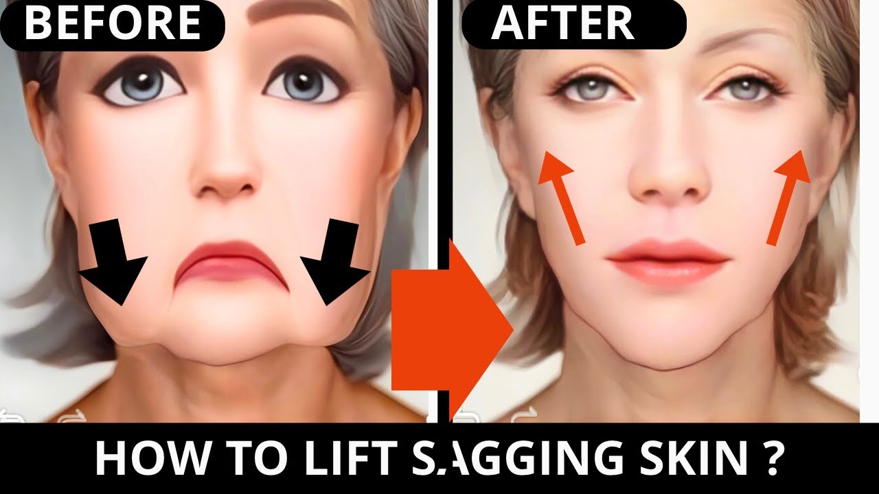ANTI-AGING FACE EXERCISES FOR SAGGING SKIN, JOWLS | FIX SAGGY SKIN ...