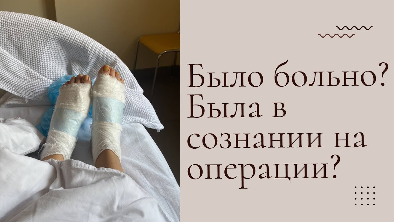 Удаление косточки на ногах Халюс вальгус Youtube