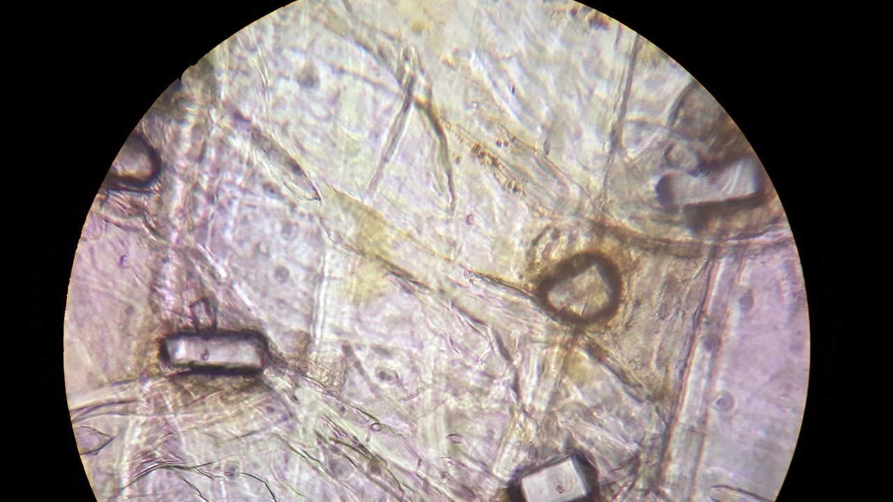 PRÁCTICA INCLUSIONES CITOPLASMÁTICAS [Cytoplasmic inclusions in the ...