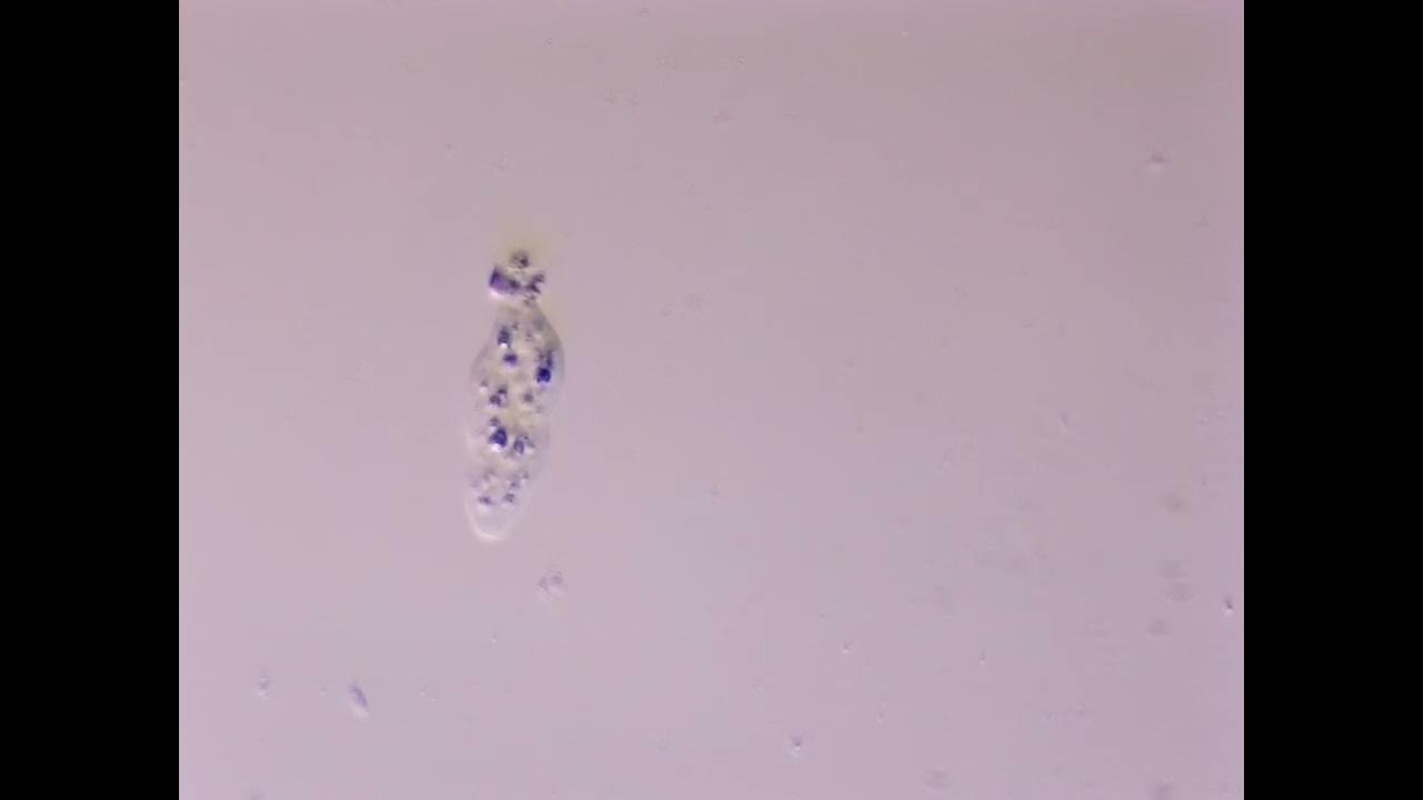 Protist under a microscope - YouTube