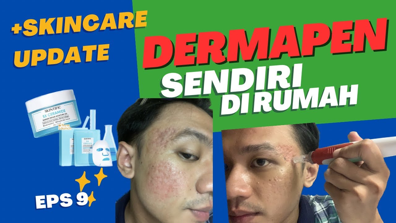 #9 DERMAPEN SENDIRI DIRUMAH LAGI EPS 9 + Update skincare routine - YouTube