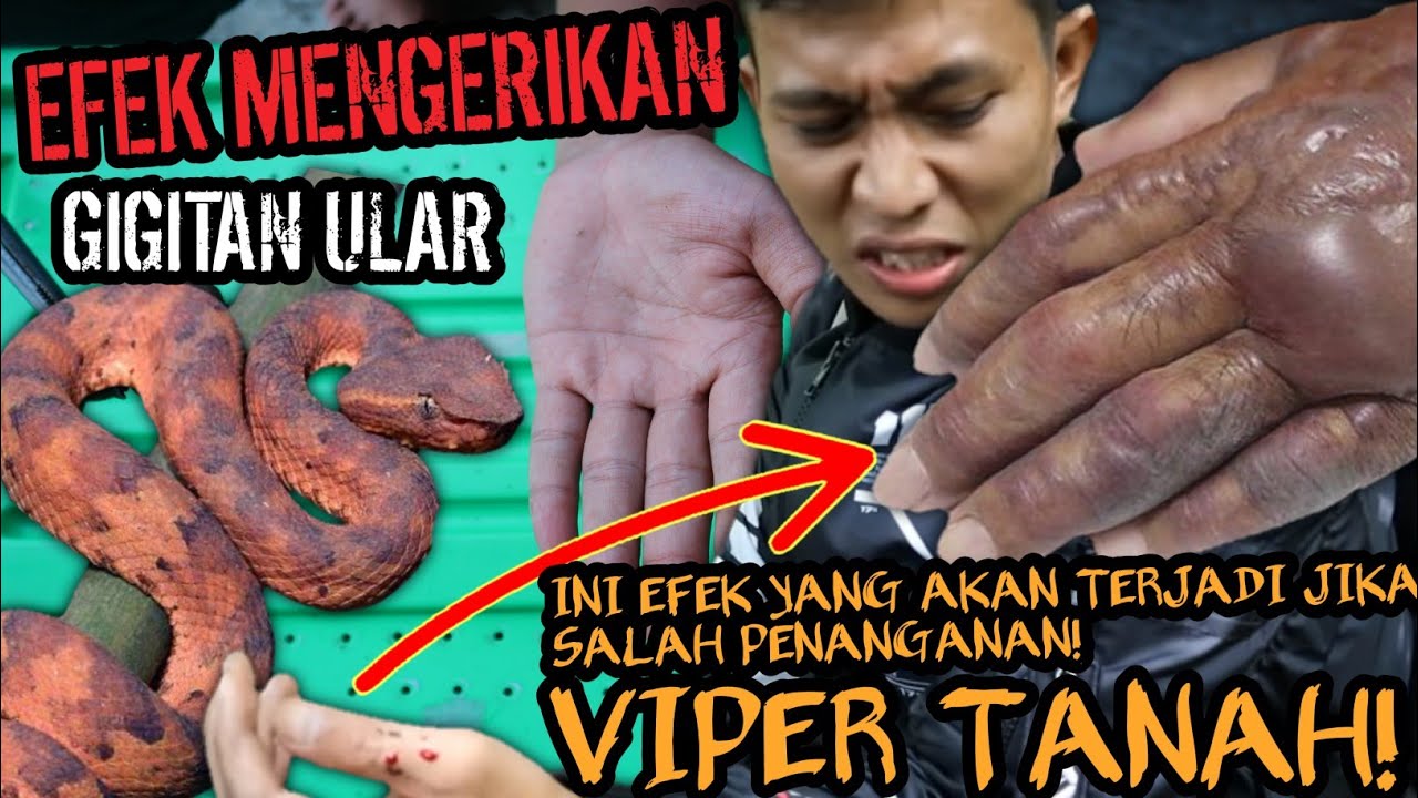 EFEK MENGERIKAN GIGITAN ULAR VIPER TANAH! 3 BULAN TERKAPAR! INI ...