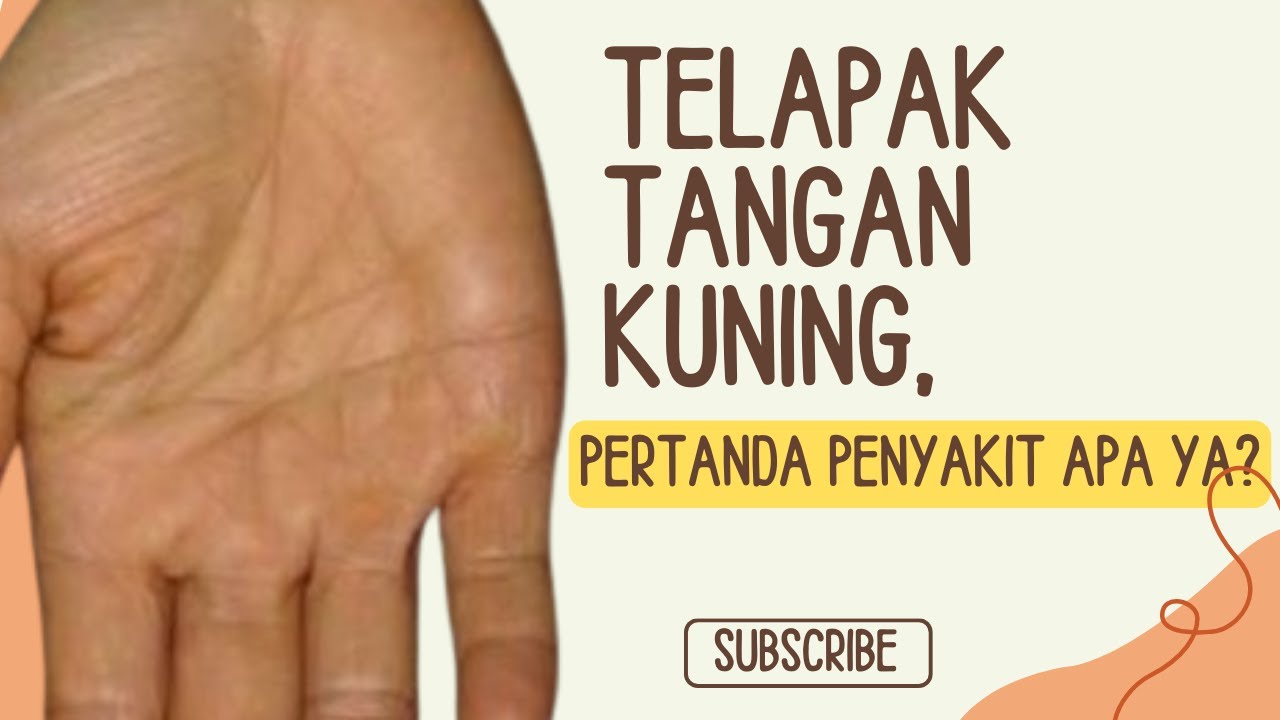 Jangan Disepelekan, Ini Penyebab Telapak Tangan Kamu Kuning # ...