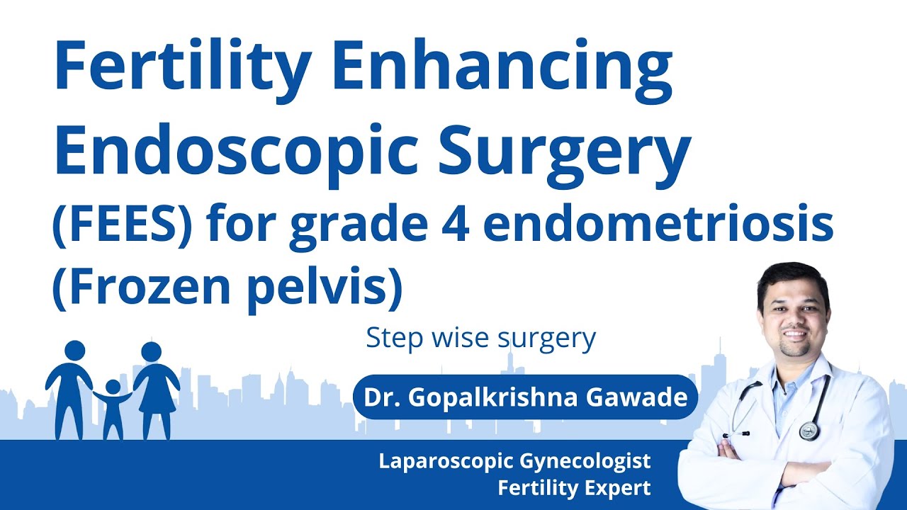 Fertility Enhancing Endoscopic Surgery (FEES) for grade 4 endometriosis ...
