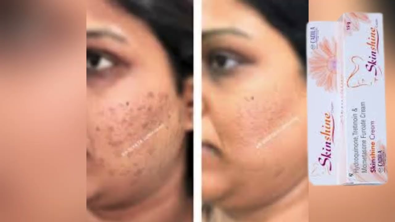 Skin shine cream 2023| side effect| benifits| how to use| यह सच्चाई ...