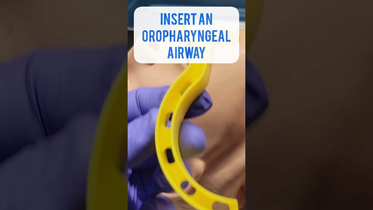 Oropharyngeal Airway (Opa) Insertion | EMS Skills | #shorts - YouTube