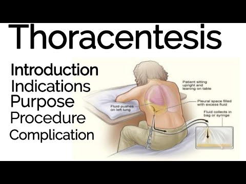 thoracentesis - YouTube