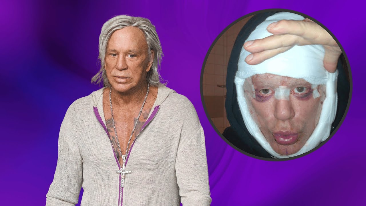 It’s No Big Secret Why Mickey Rourke Isn’t Around Anymore - YouTube